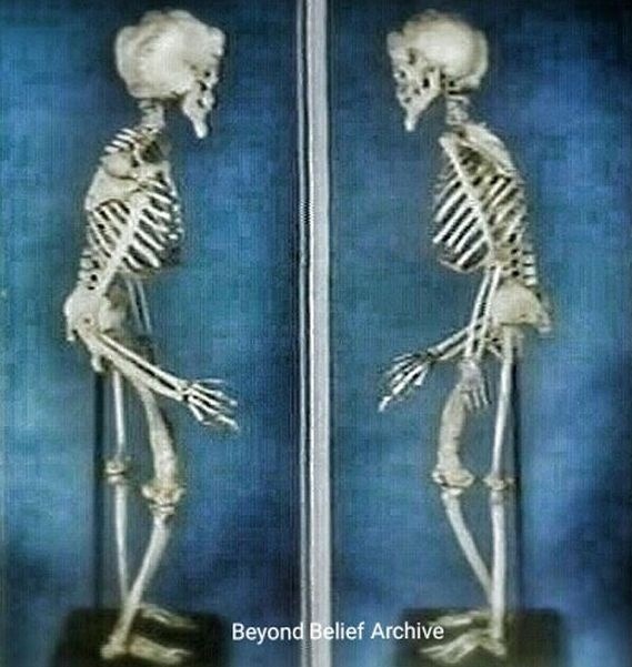 Ako naozaj vyzeral legendárny Sloní muž: Posmrtné FOTO jeho ...