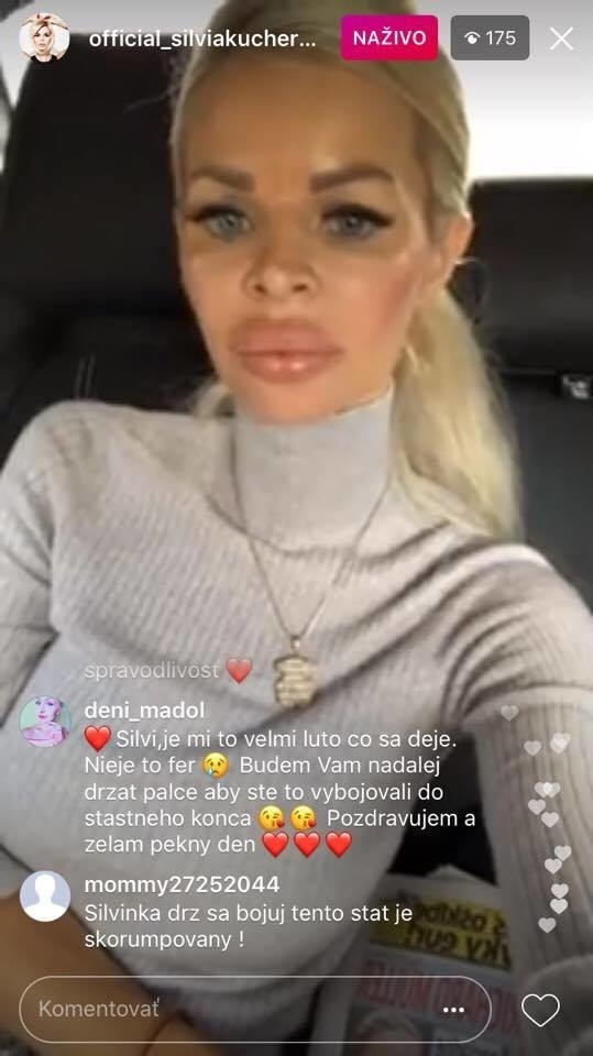 Kucherenko prezradila, koľko váži: Silvia, strašne riskuješ! – galéria ...