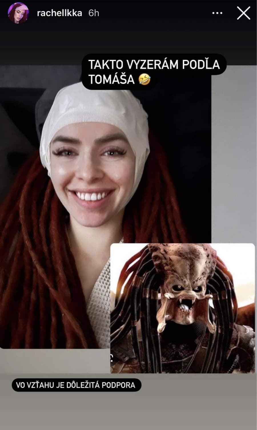 Lacná kráľovná z Nákupných maniačok opäť na PLASTIKE: Po prsiach si ...