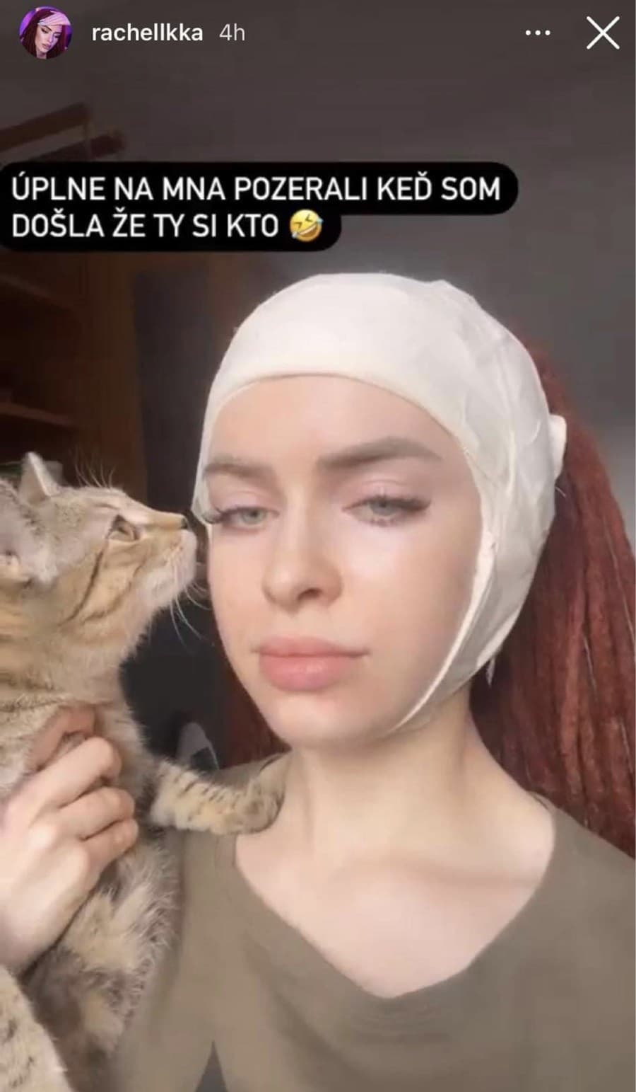 Lacná kráľovná z Nákupných maniačok opäť na PLASTIKE: Po prsiach si ...