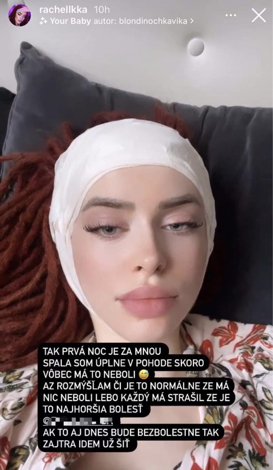 Lacná kráľovná z Nákupných maniačok opäť na PLASTIKE: Po prsiach si ...