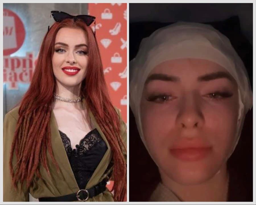 Lacná kráľovná z Nákupných maniačok opäť na PLASTIKE: Po prsiach si ...