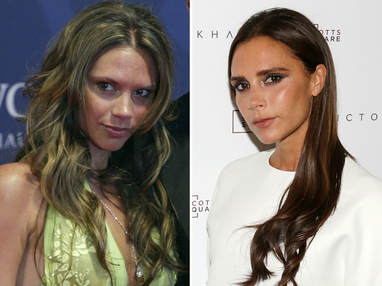 Gény alebo nenápadná plastika? Tieto krásky vyzerajú posledných 10 ...