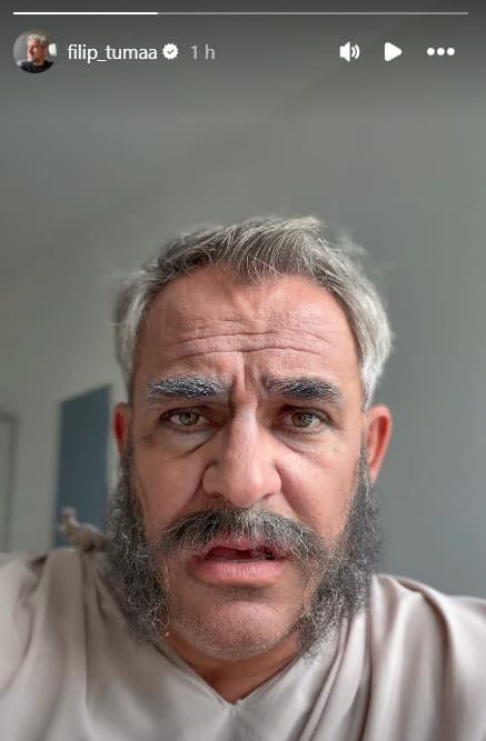 Filip Tůma s novým imidžom: Och, vyzerá horšie ako Anton Holubec!