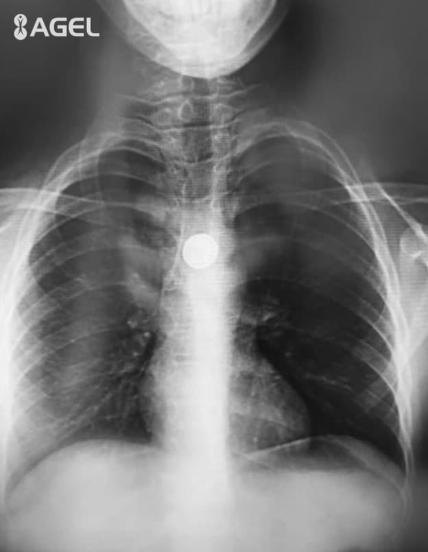 RTG snímka - fotogaléria | Špuntík.sk