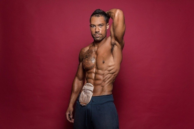 Blake Beckord sa i napriek zdravotným problémom stal fitness modelom ...