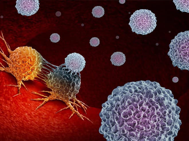 obrázky | Vyšetrenie.sk