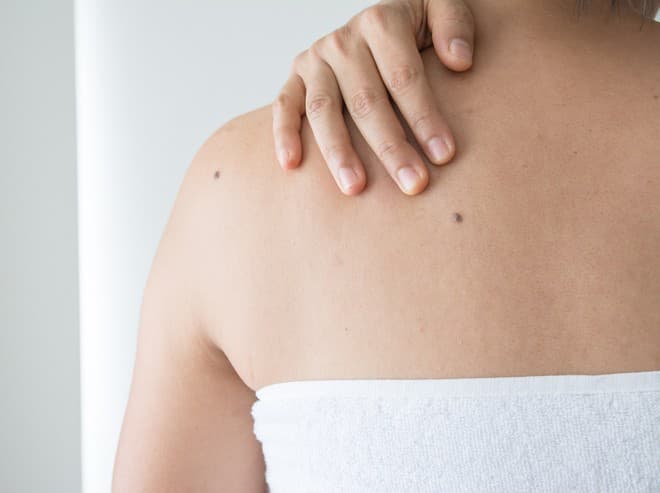 obrázky | Vyšetrenie.sk